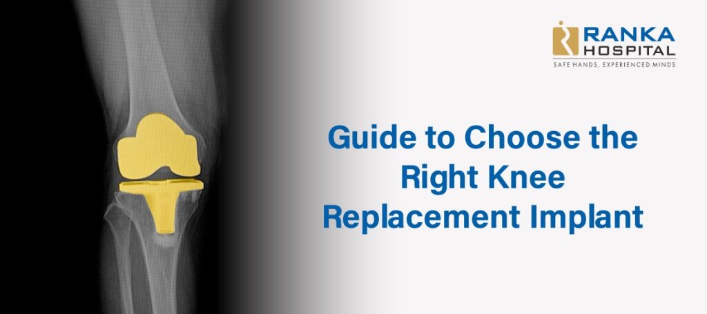 Guide to Choose the Right Knee Replacement Implant - Ranka Hospital
