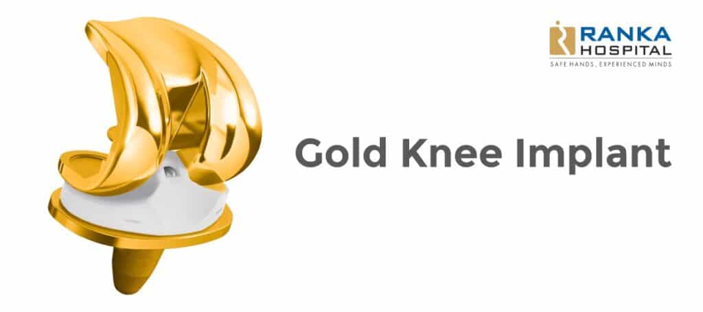 Gold Knee Implant - Ranka Hospital